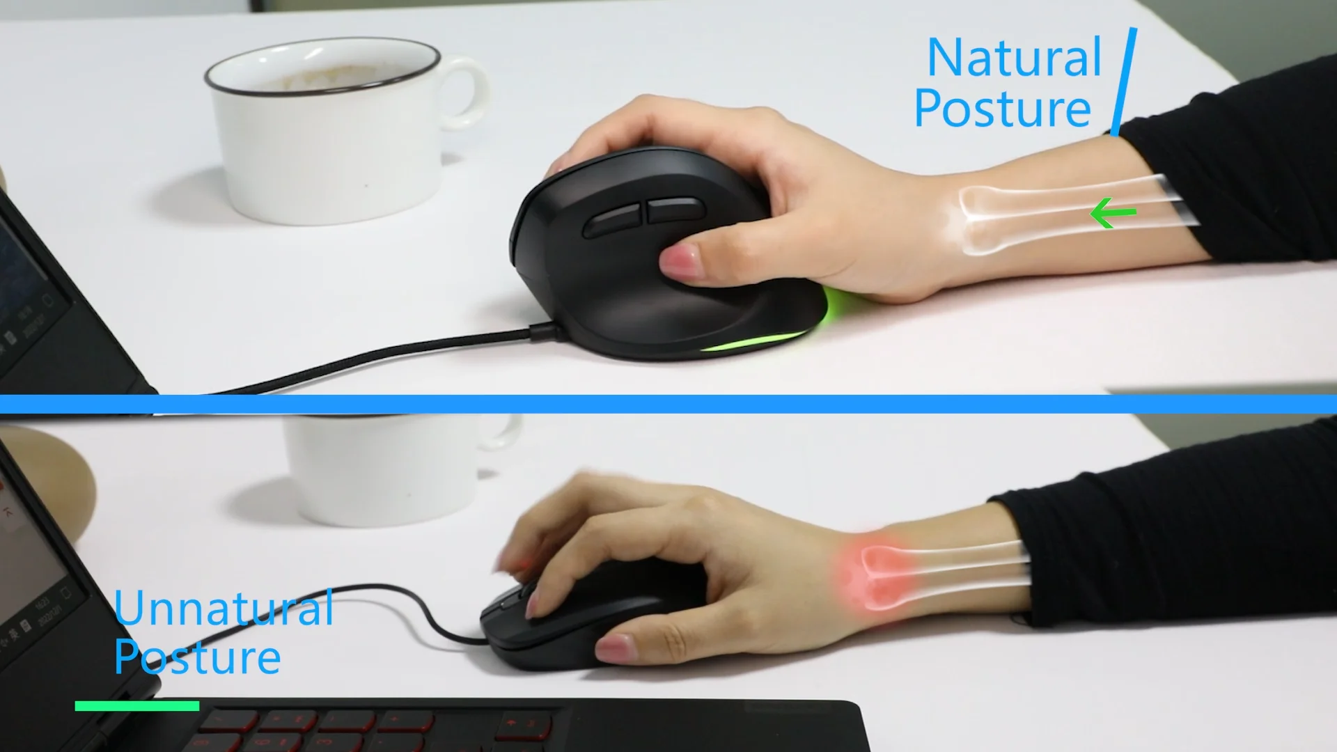 2.4g Wired Right Handed Mouse Custom 6 Buttons Ergonomic Wireless ...