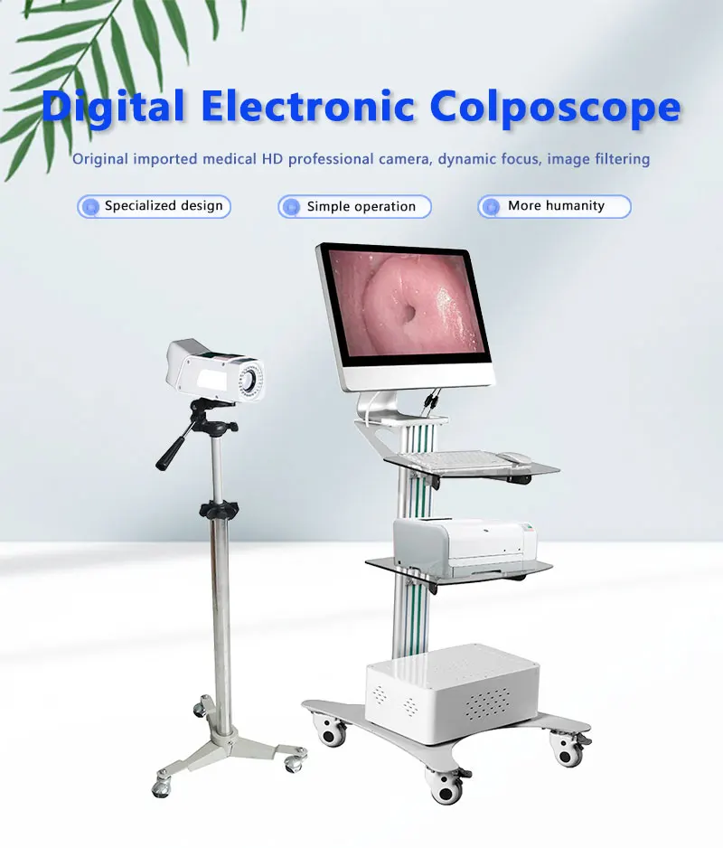 Portable Vaginal Colposcope Video Colposcope Camera For Gynecology ...