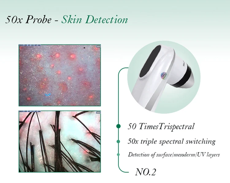 USB Digital Hair Transplant Microscope - 3D Dermatoscope