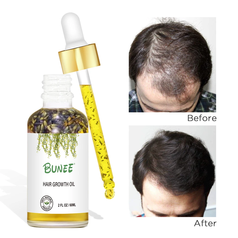 Bunee Hair Growth Serum - Organic Formula with Rosemary Oil