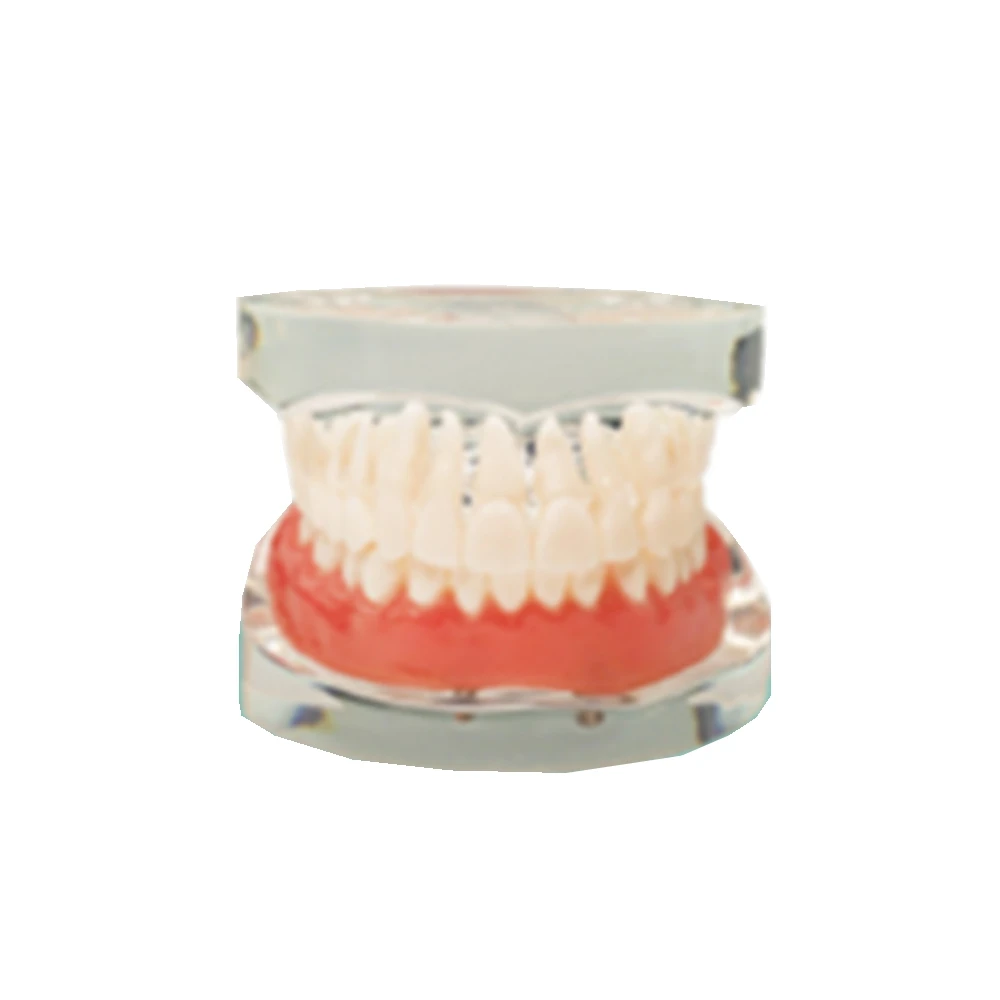 Dental Implant Education Model Mandibular Denture Implant Repair Model ...