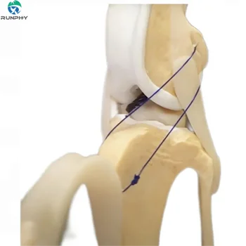 Lateral Suture Technique Dog Knee Surgery Veterinary Orthopedic ...