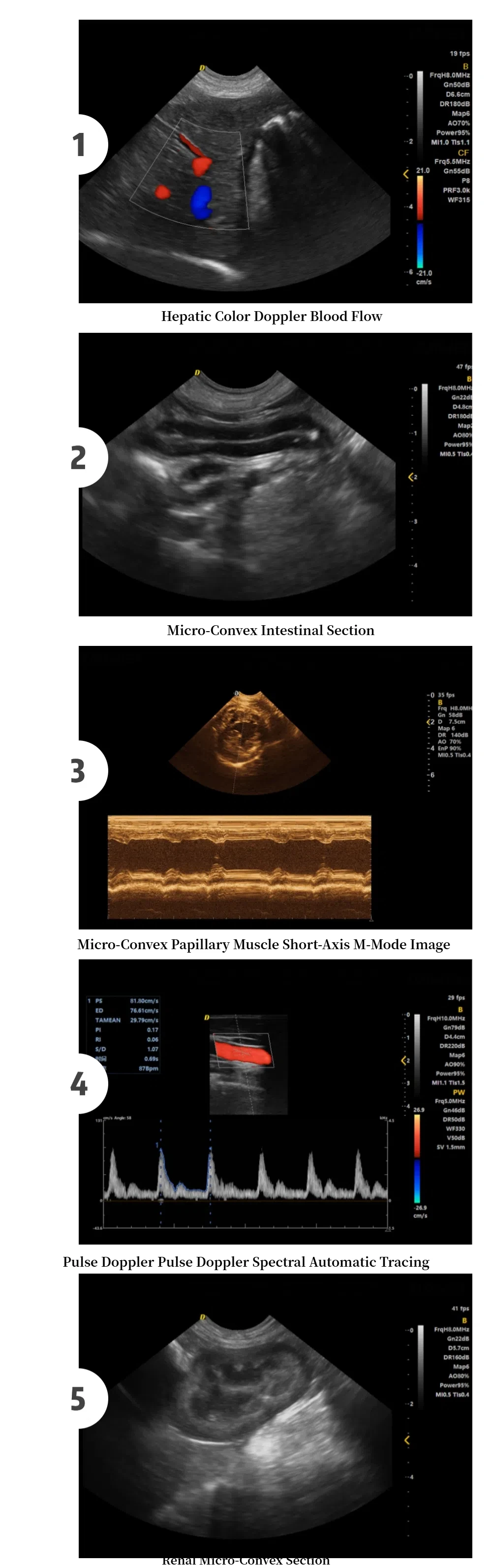 Portable Color Doppler Ultrasound 3D/4D/5D F3 Veterinary Applications ...