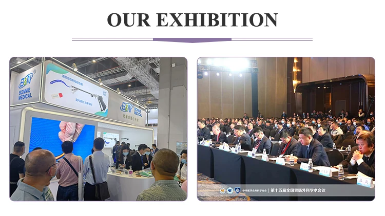 Urinary Instruments Disposable Circumcision Stapler Zsr Circumcision ...