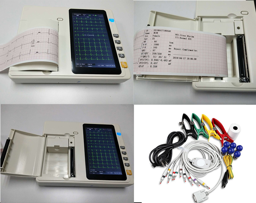 Fast Data 3 Channel ECG Machine - 12 Lead Electrocardiograph