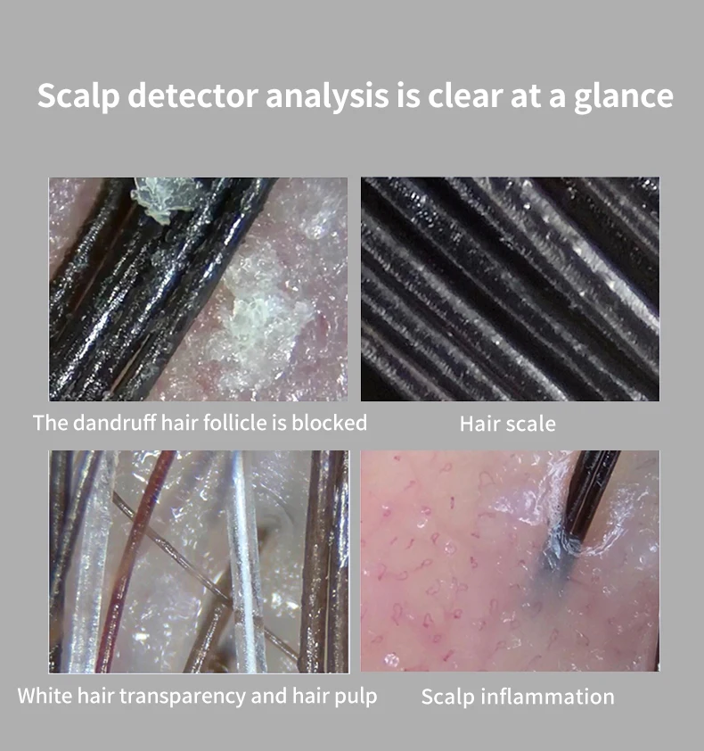 New Skin Analyzer Scalp Hair Camera Scanner Wireless Wifi Connection ...