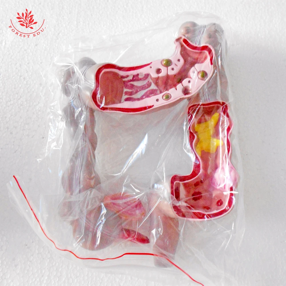 Colon Comprehensive Pathology Model Gastrointestinal System Pathology ...