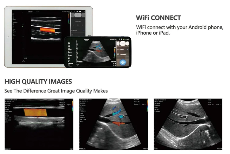 192 Element Phased Array Cardiac, Linear & Convex 3 in 1