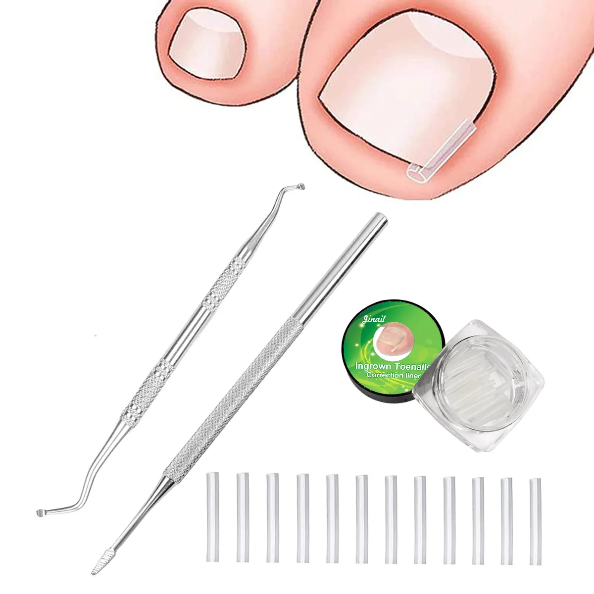 Stainless Steel Toenail Correction Pedicure Tool for Nail Recover Foot ...