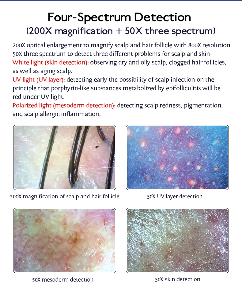 Scanner to See Hair Follicle Hair Follicle Scalp Scanner Hair Analysis ...