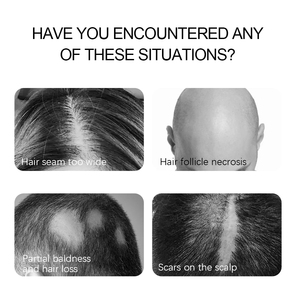 Scalp Microblading Pm Organic Pmu Plant Based Inks Smp Eyebrows Scalp ...