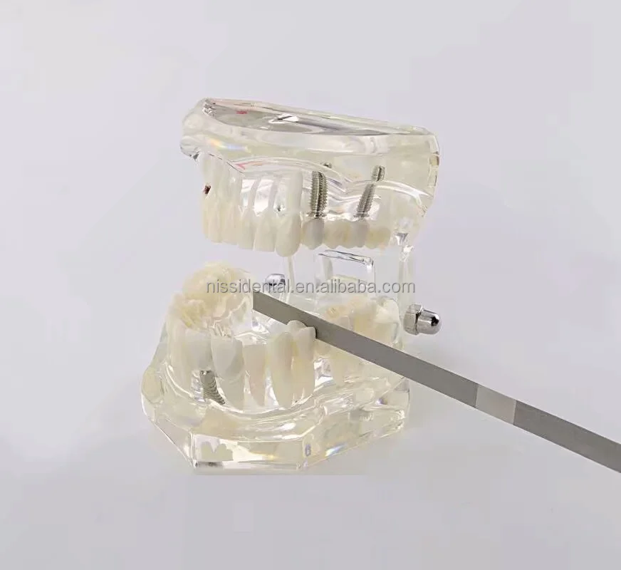 Dental Interproximal Enamel Reduction Orthodontic Diamond IPR Strips 10 ...