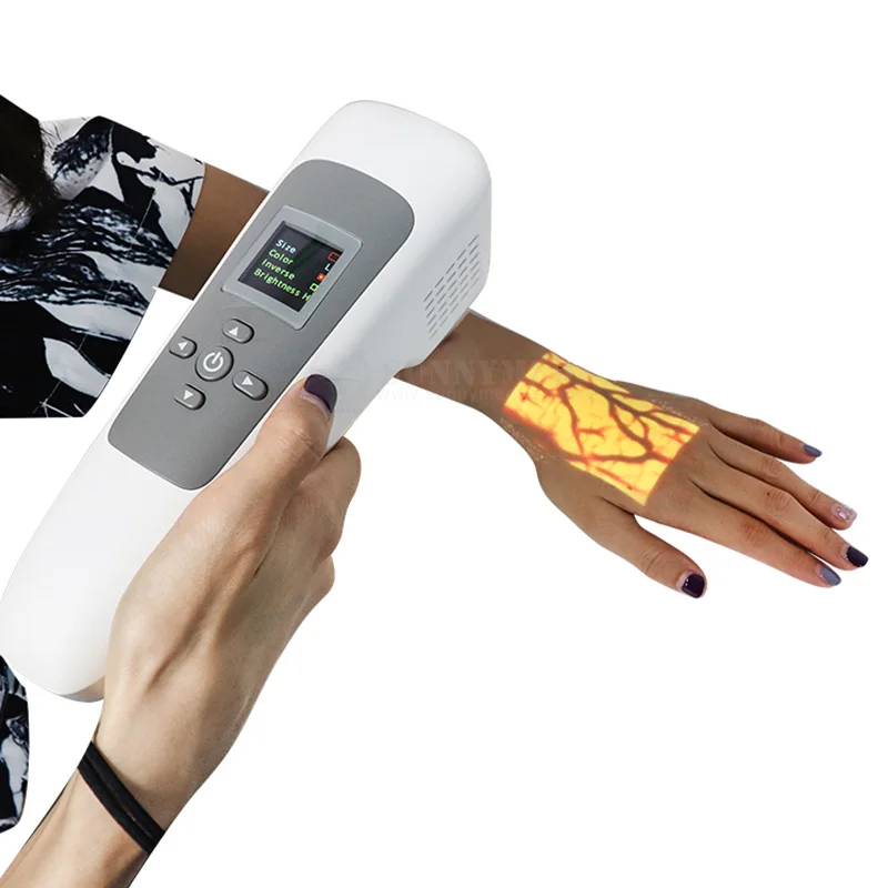 SY-G090S Handheld Vein Viewer - Precision and Portability