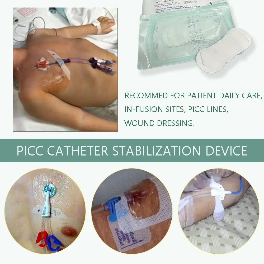 Adhesive Dressing For Fixing Picc Catheter Sterile - Buy Fixing Picc Catheter Central Venous ...