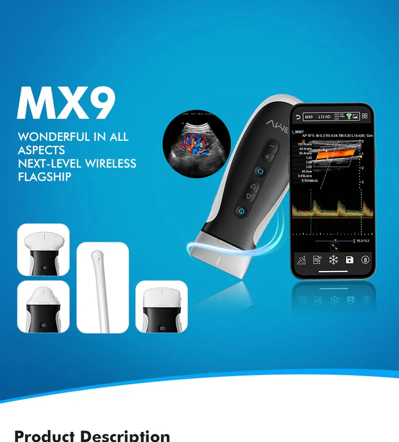 USB Ultrasound Medical Scans - Convex Linear Probe BMV MX9