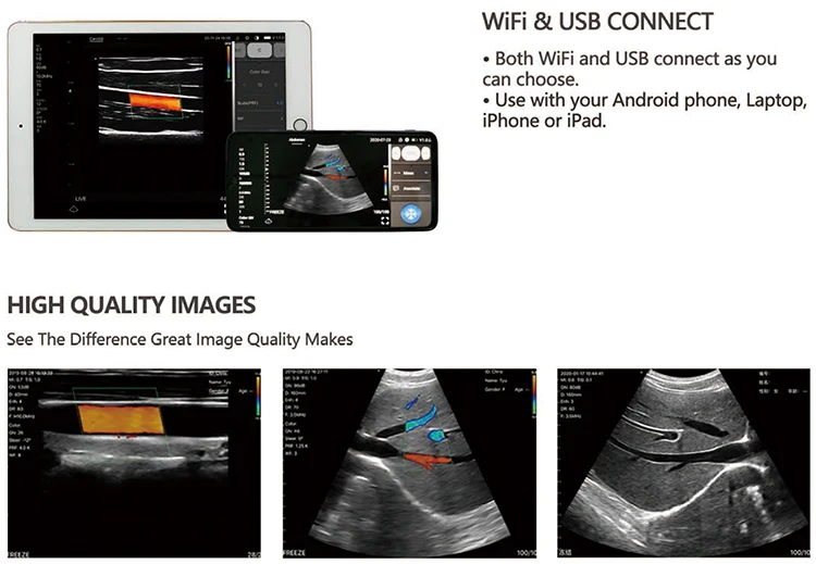3 in 1 Linear Convex Double Probes - Portable Ultrasound