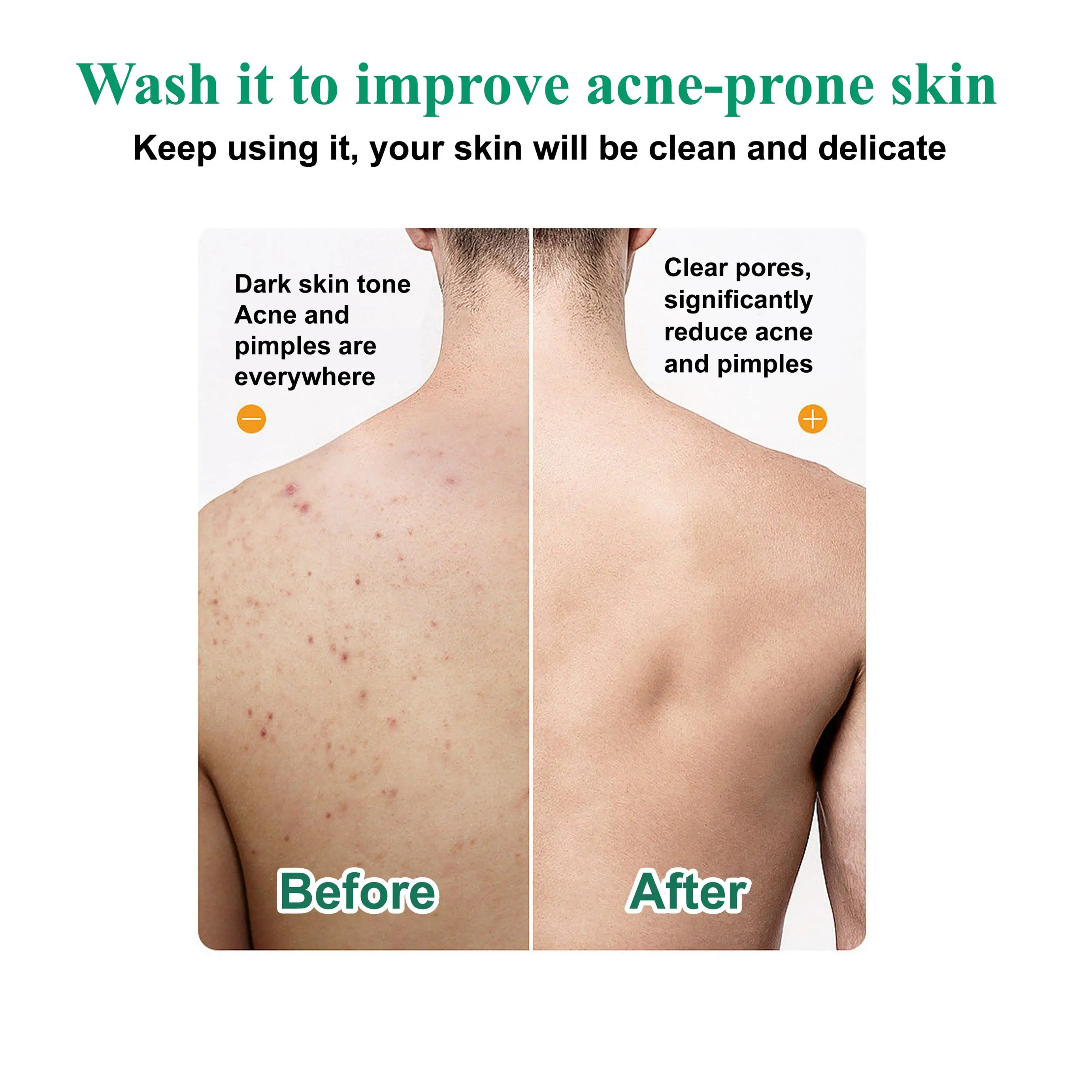 ROUSHUN Custom Kojic Acid Shower Bath - Brightening & Anti-wrinkle
