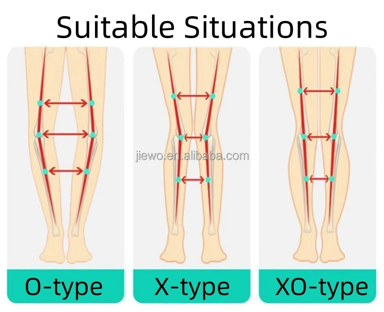 Leg Posture Corrector Band - Adjustable X O Legs Bandage