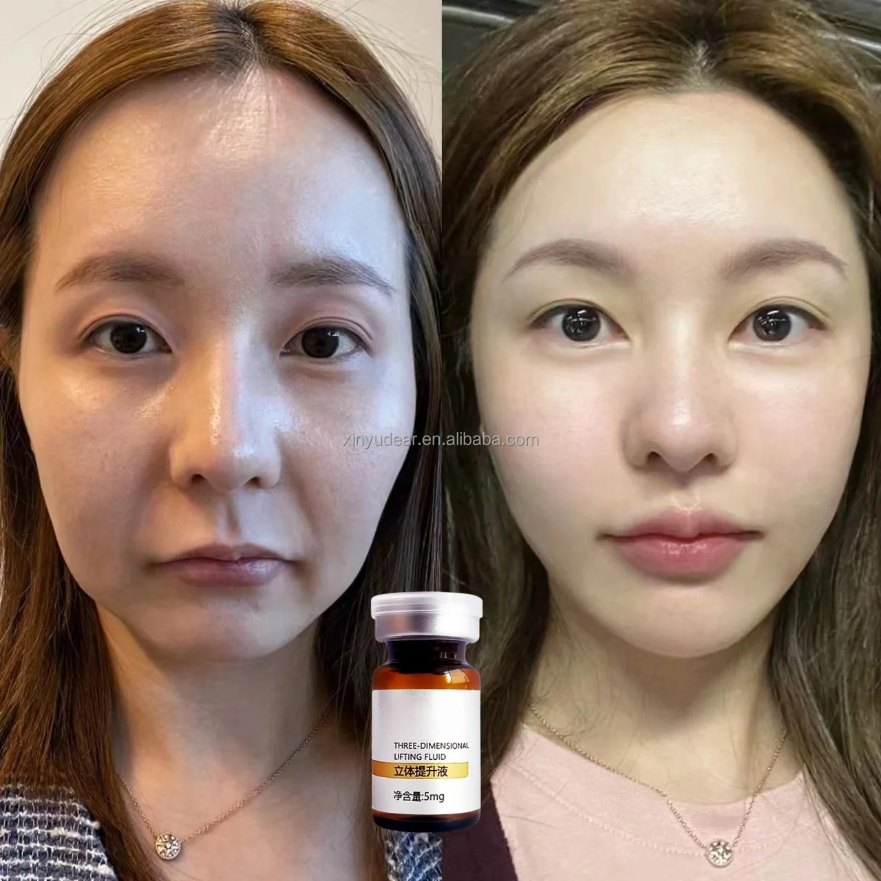 OEM Factory Saggy Skin V Line Vial - Instant Face Lift