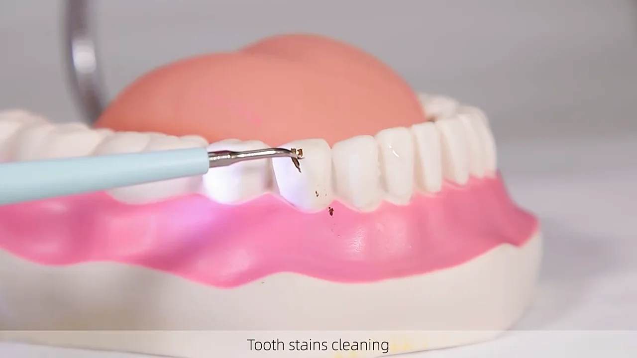 Dental Cleaner Plaque Tartar Remover Dental Calculus Remover Ultrasonic ...