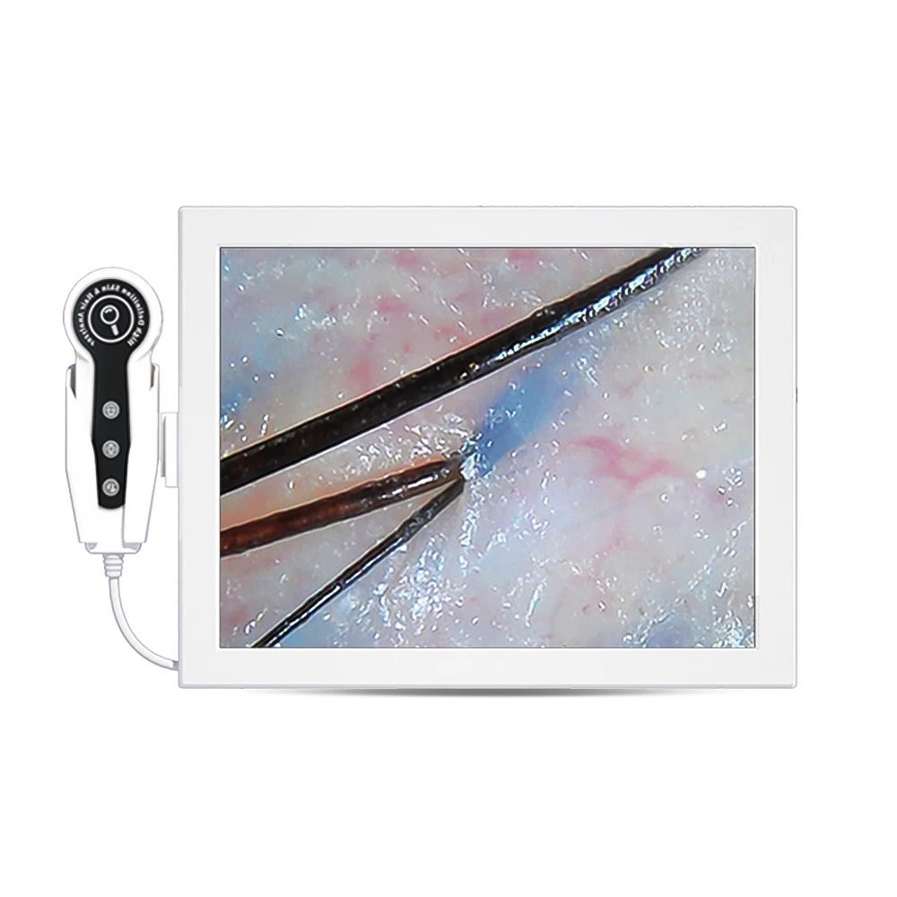 Portable Big Screen Hair Scalp Analyzer - Konmison JC062