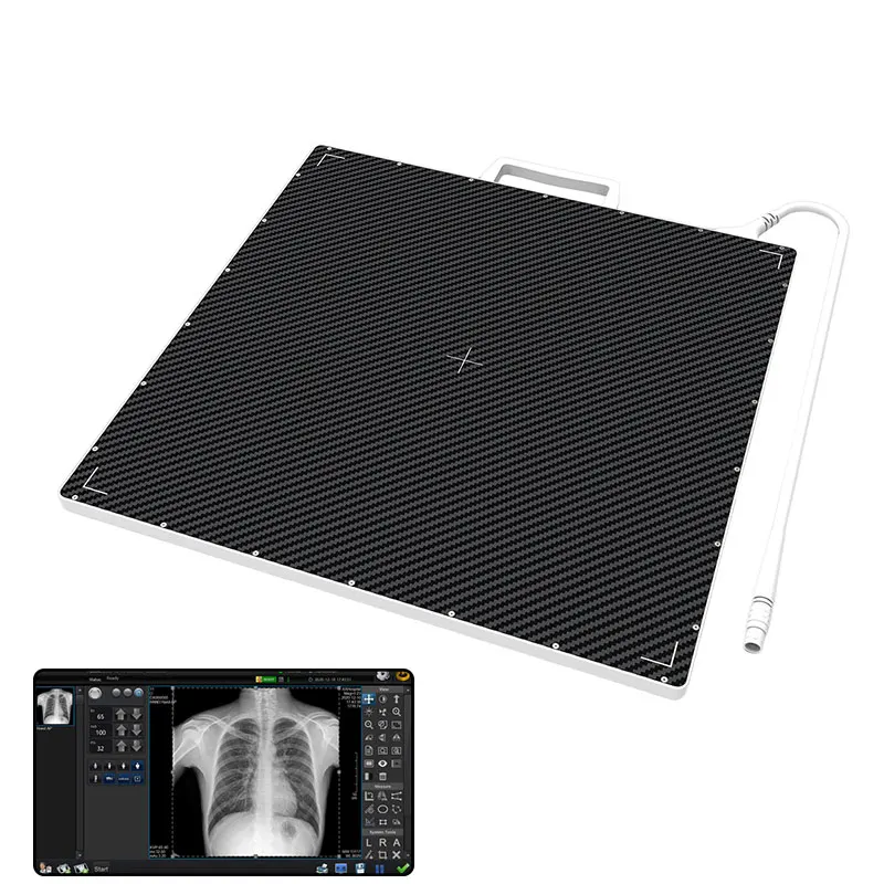 Medsinglong Medical X Ray Radiation Equipment - Portable & Digital