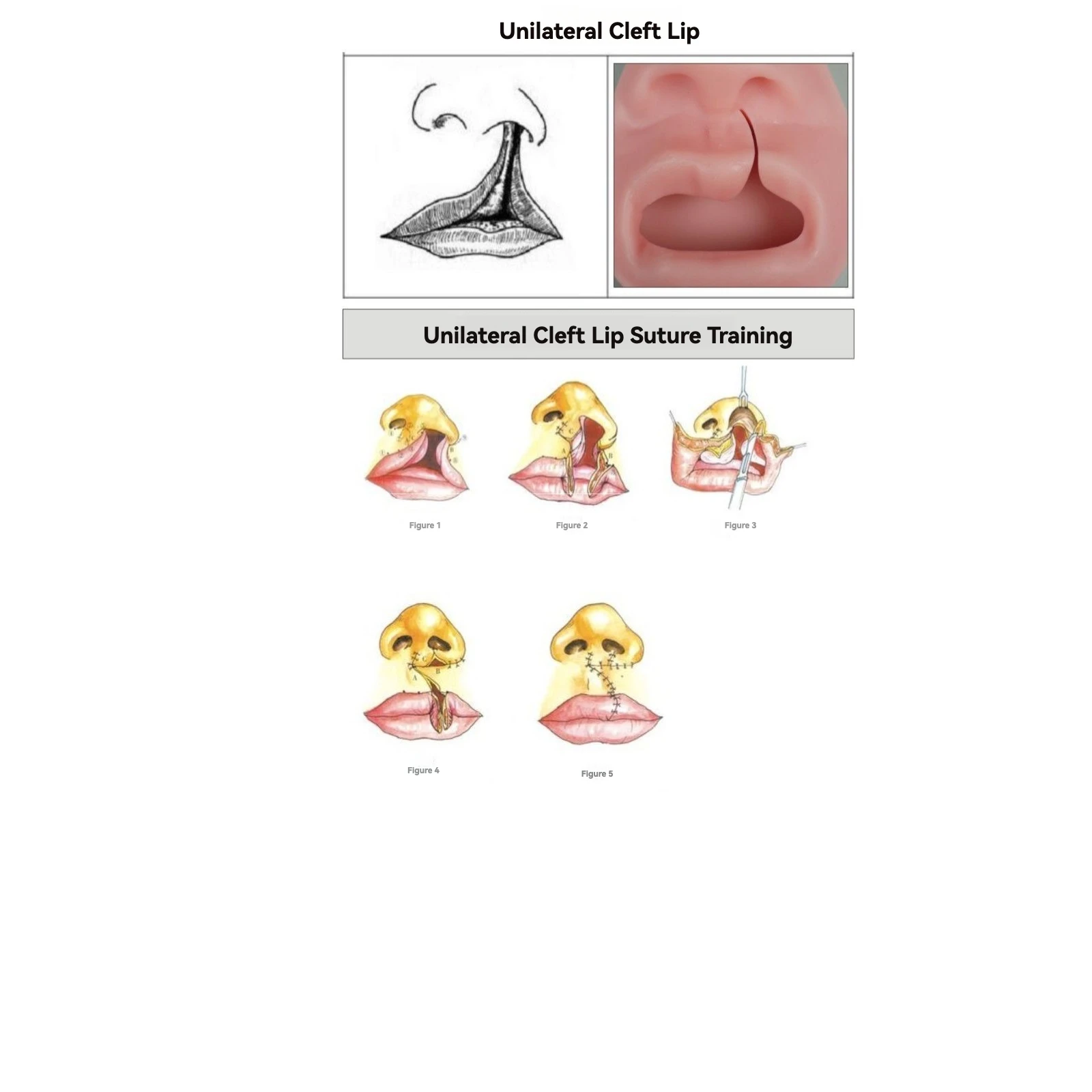KyrenMed Lip Fissure Closure Surgery Training Model Silicone Harelip ...