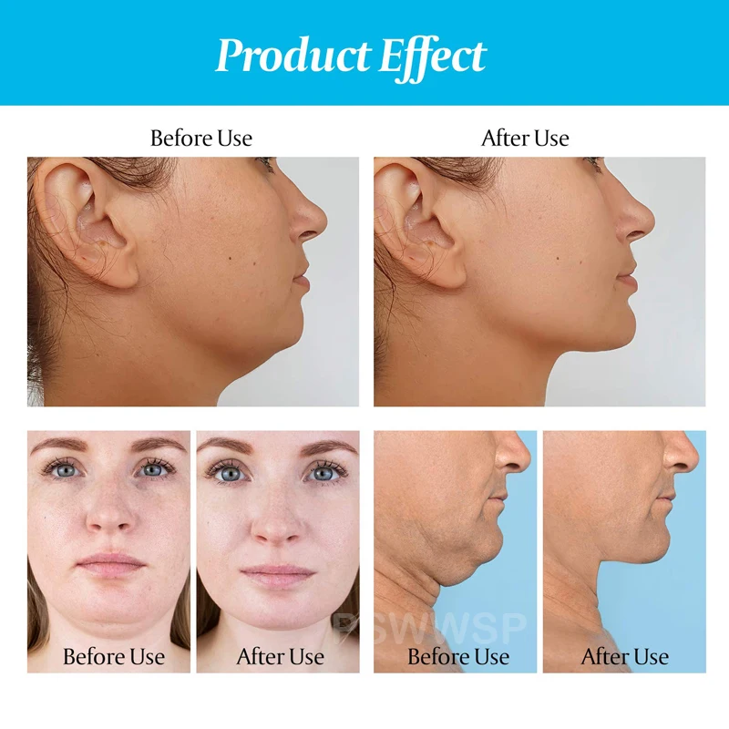 2023 New Products Jaw Muscle Exerciser Silicone Jaw Face And Neck ...