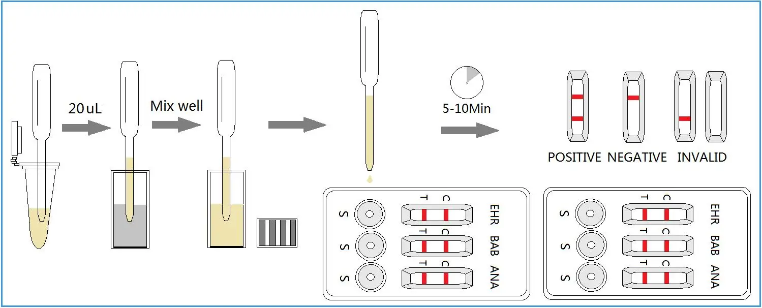 Canine Ehrlichia Anaplasma Babesia Gibsoni Combo Test Kit