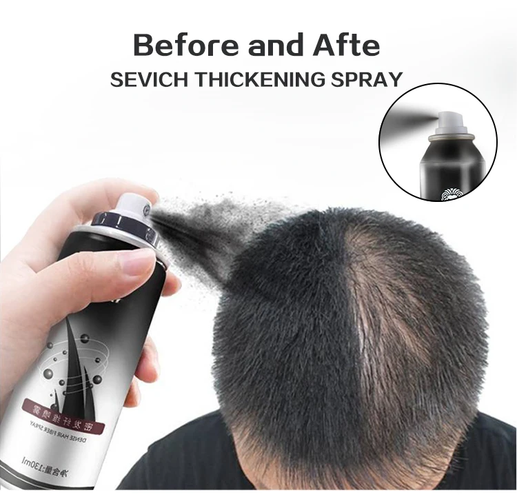 Best Hair Building Fibers Dense Spray for Hair Loss Treatment