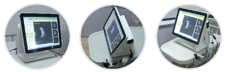 Ophthalmic AB Scan SAB-500 Eye Diagnostic Ophthalmology Ultrasound ...