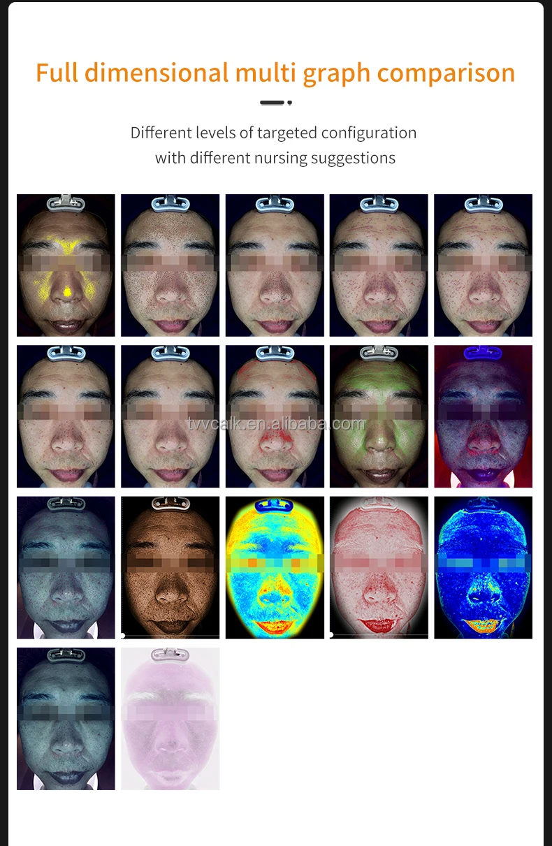 3D AI Facial High-Definition Comprehensive Facial Skin Analysis Beauty ...