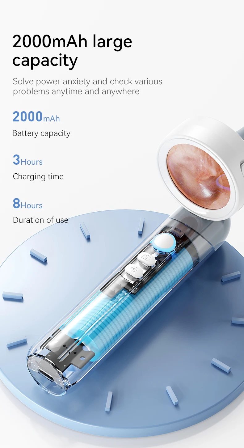Q10 Smart Ear Canal Detector Ear Camera 1080P with 1.38" Screen - Ideal ...