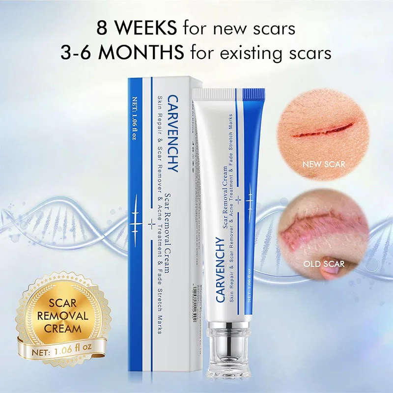 Wholesale Scar Repair Cream - Fade Stretch Marks Safely