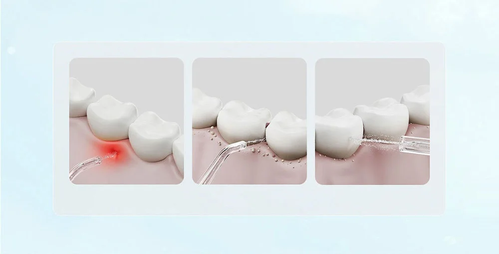 Xiaomi Mijia Meo703 Portable Water Flosser F300 Tooth Cleaner ...