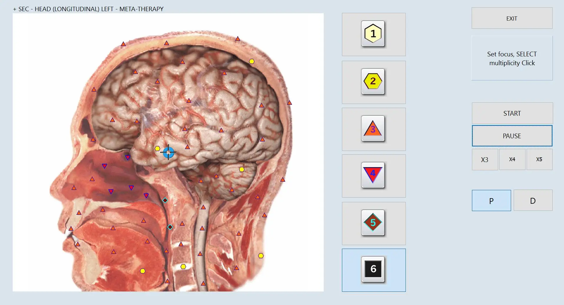 Metatron Hunter 4025 Bioresonance V20 NLS Aura Chakra Analyzer