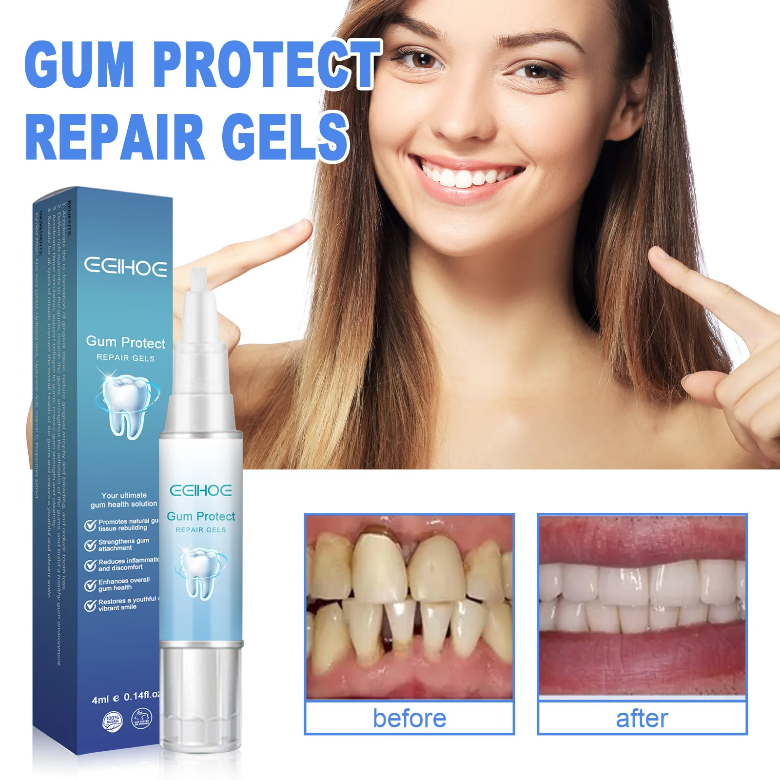 Eelhoe Tooth Repair Gel Repair Swelling And Aching Of Gum Deep Cleaning ...
