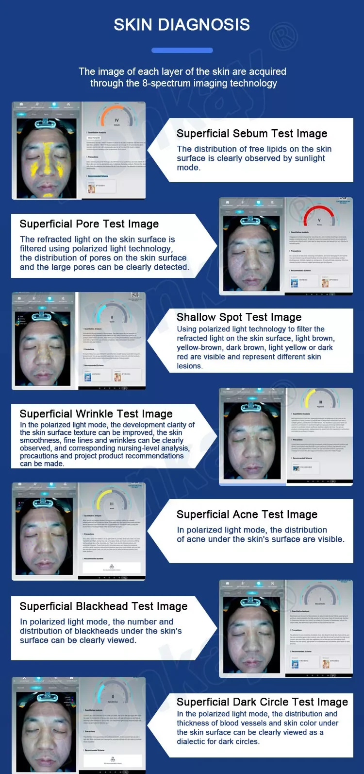 Custom Language Smart Skin Diagnostic Analyzer Facial Skin Scope Uv ...