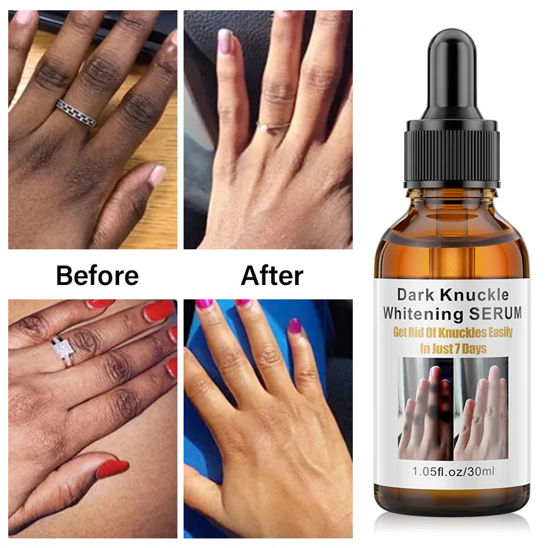 Lightening Glowing Bleaching Full Body Black Skin Strong Bleaching Body ...
