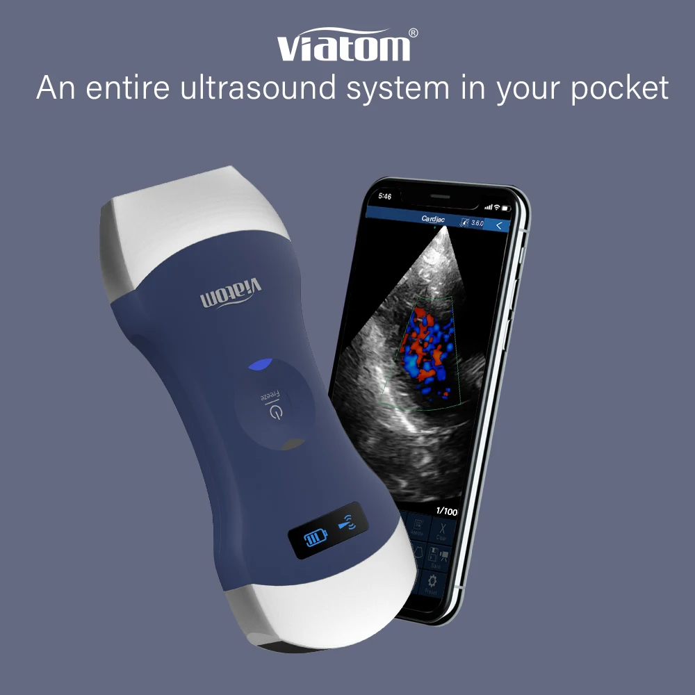 Viatom Dual Head Ultrasound Scanner - Portable & Wireless