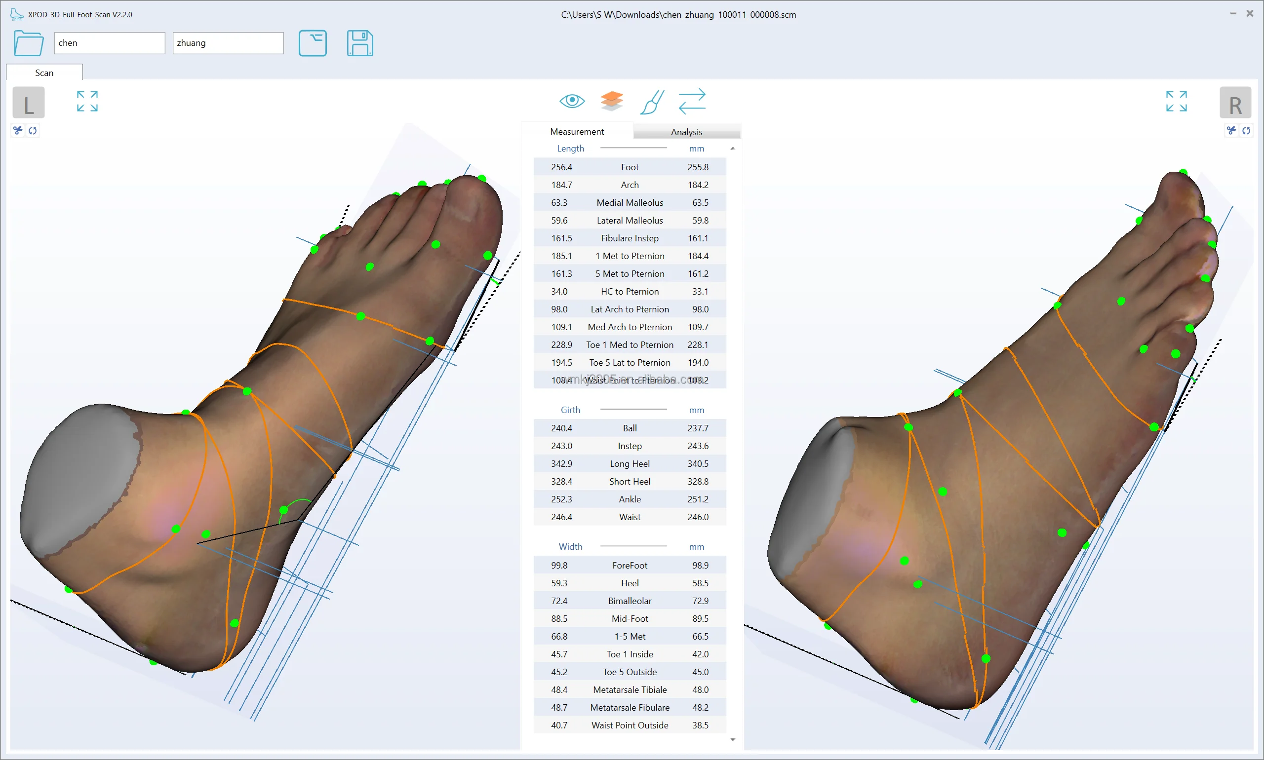 3d Foot Scanner Xpod-ss2 Vismach Diabetic/orthotic Insoles/shoe Last ...