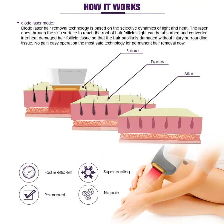 Vertical Big Spot Size Germany Bars 808 Diode Laser / 808nm Diode Laser ...