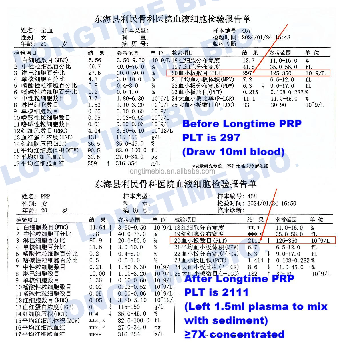 Longtime Blood Test Tubes Regen Lab Prp Tubes Activator 10ml With ...