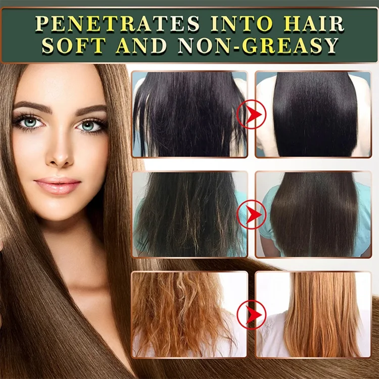 YURHERSU 5 Days Hair Treatment Nuriten Solution Ginger Hair-loss Hair ...