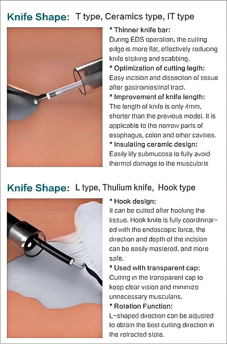 Professional Endoscopic Dissection Knife Disposable Endoscopic ...