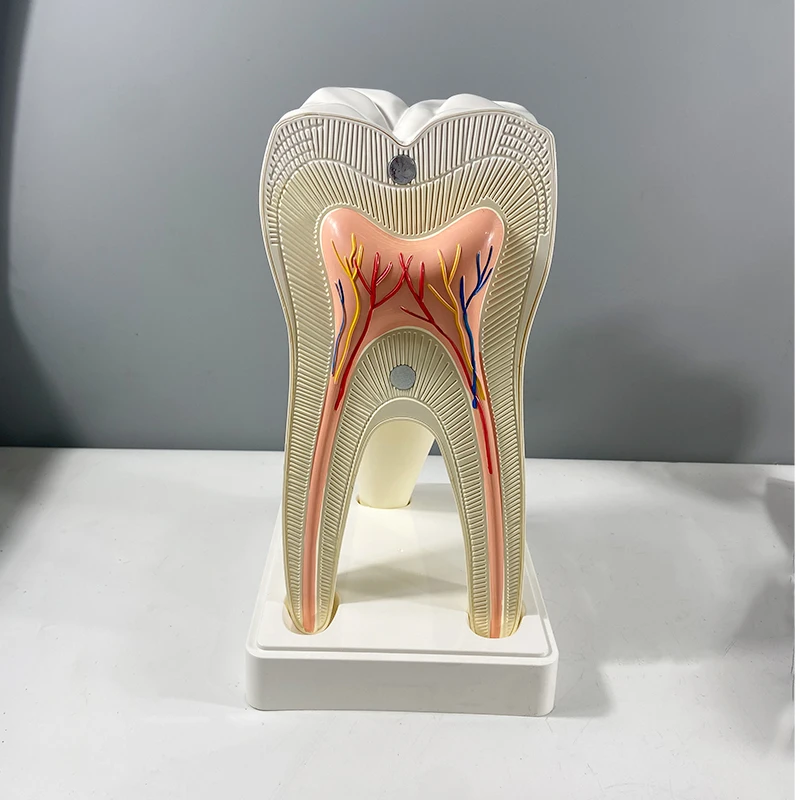 Medical communication, dental anatomy, enlarged model display, dental ...