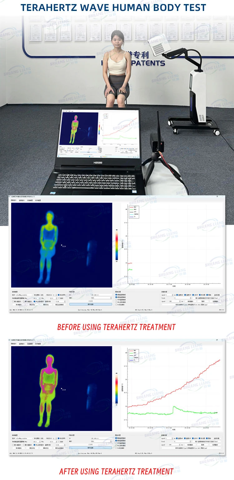 2025 Terahertz Physio Magneto Therapy Machine - Full-Body Massage