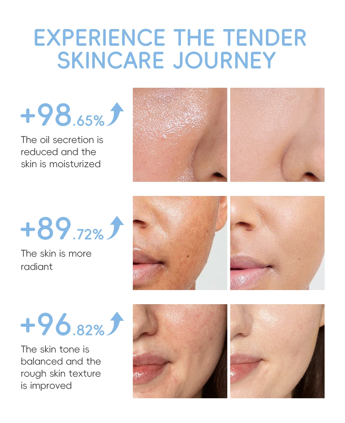 LAIKOU Milk Skincare Set - 5-Piece Face Care Kit with Niacinamide ...