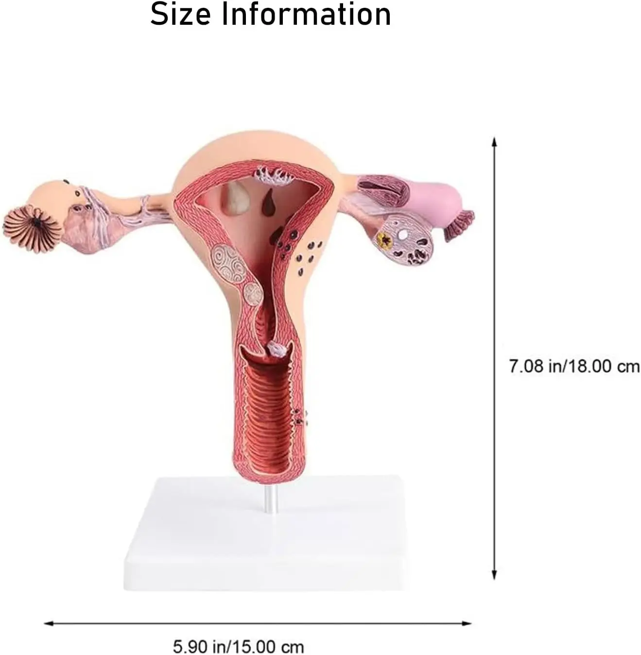 Teaching Learning Tool Gynecological Uterus Structure Anatomy Model ...