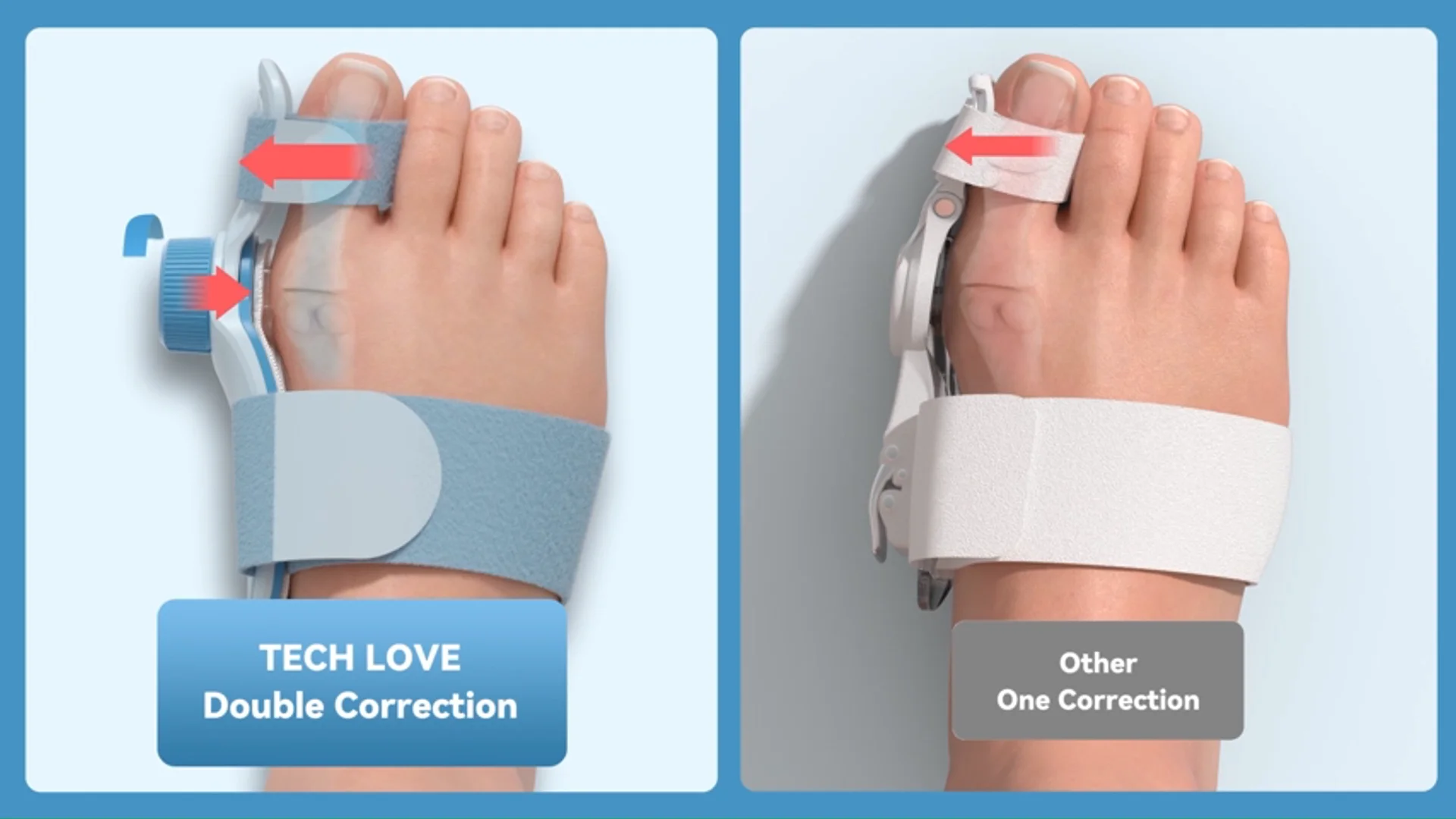 Tenicore Big Toe Straightener Splint Bunion Corrector Hallux Valgus ...